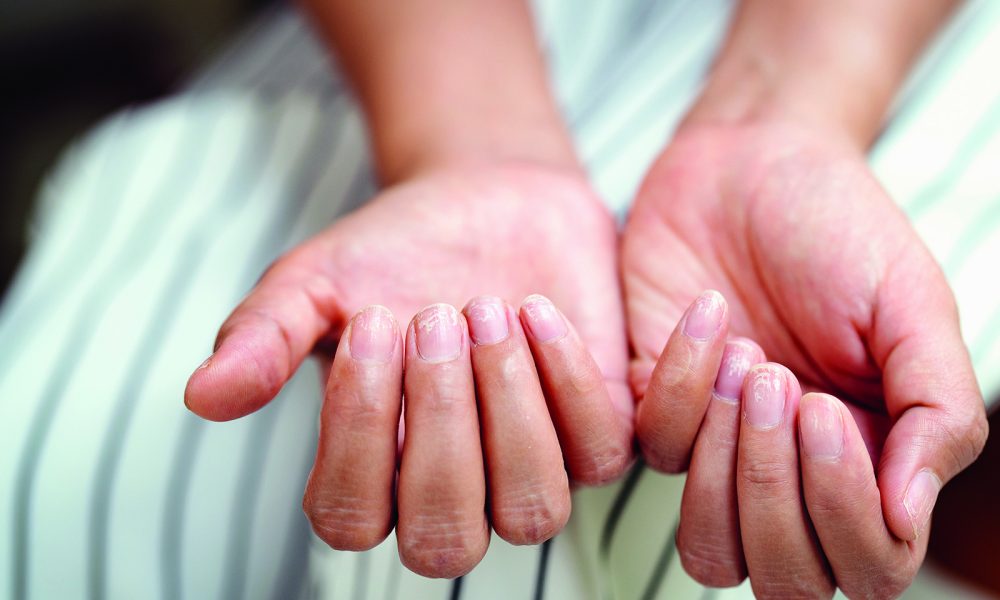 What your nails say about your health - Royal Examiner