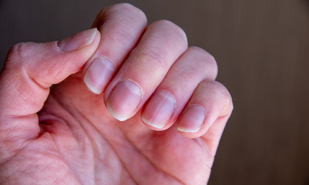 Fingernails: More Than Just a Fashion Statement - Royal Examiner